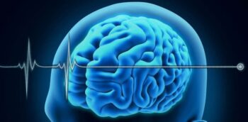 Understanding Brain Death